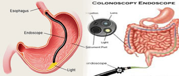 Vincentians received free Endoscopy and Colonoscopy services